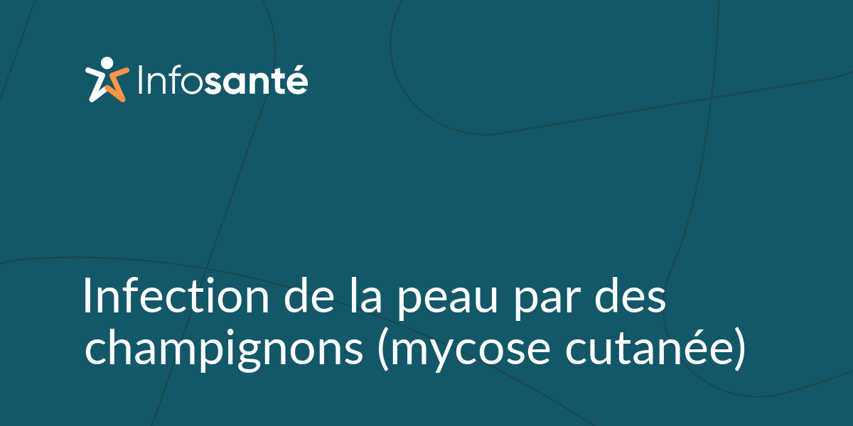 Infection de la peau par des champignons (mycose cutanée) • Infosanté