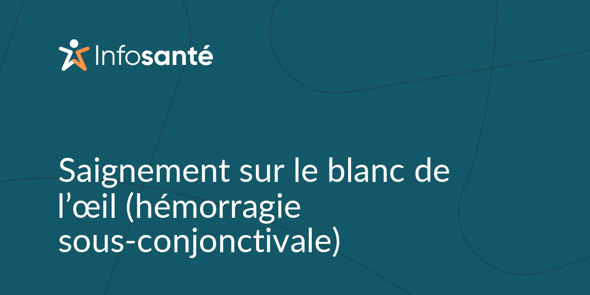Saignement sur le blanc de l’œil (hémorragie sous-conjonctivale ...