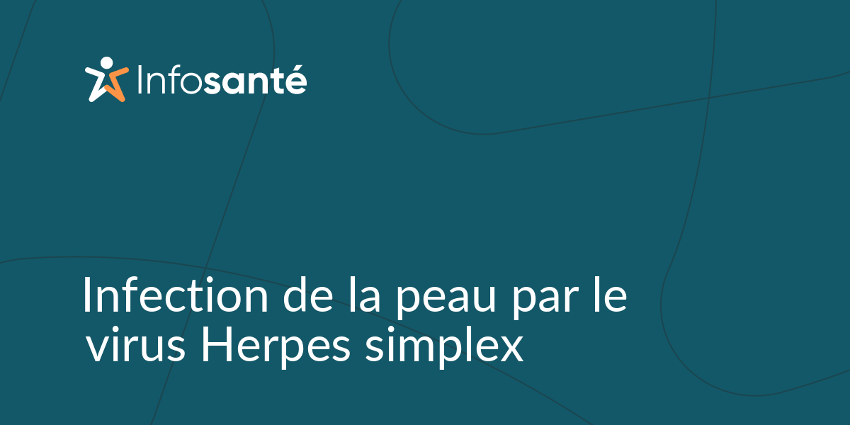 Infection de la peau par le virus Herpes simplex • Infosanté