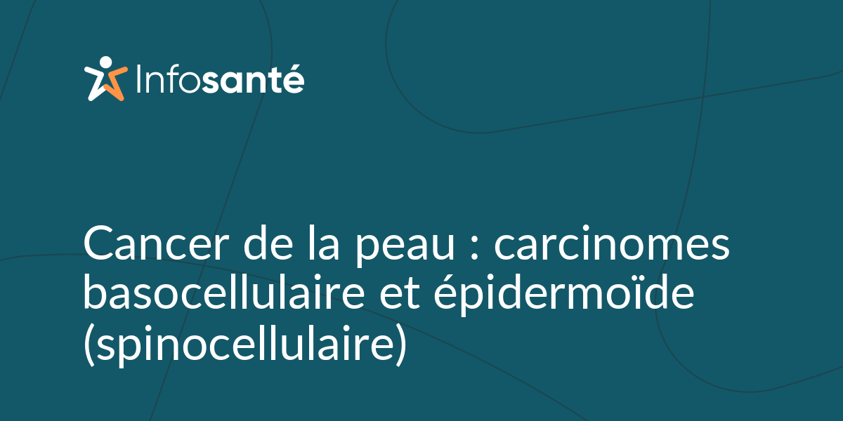 Cancer de la peau : carcinomes basocellulaire et épidermoïde ...