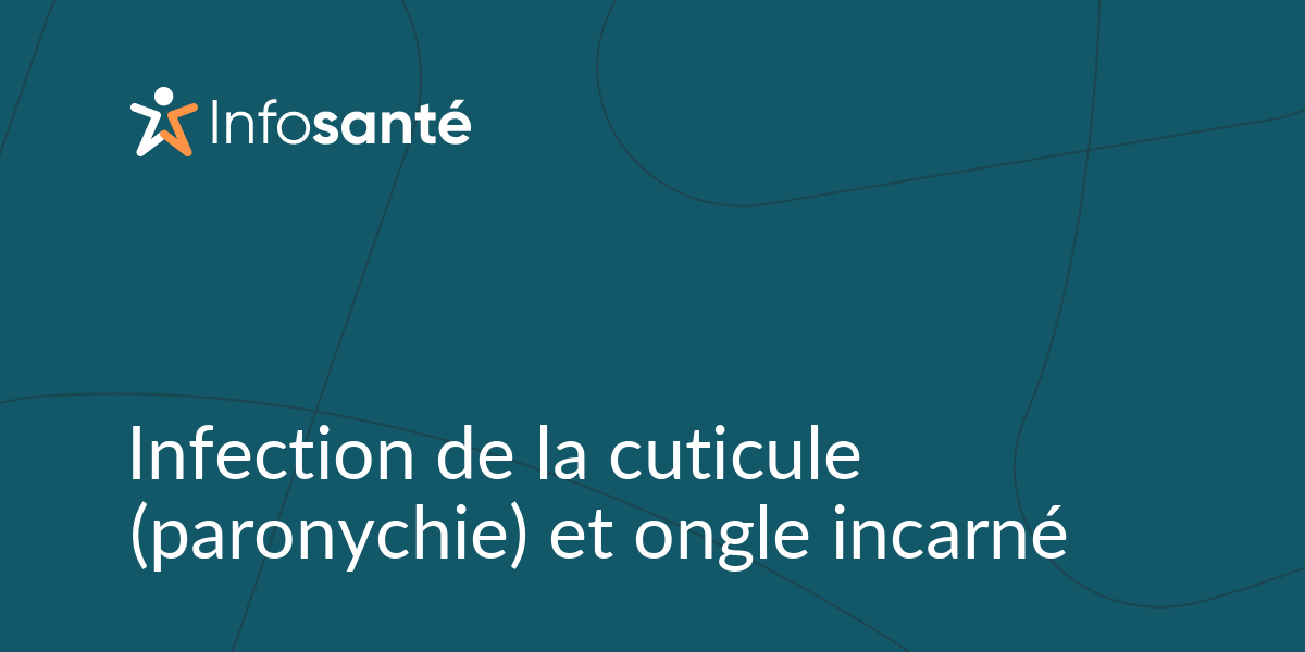 Infection de la cuticule (paronychie) et ongle incarné • Infosanté